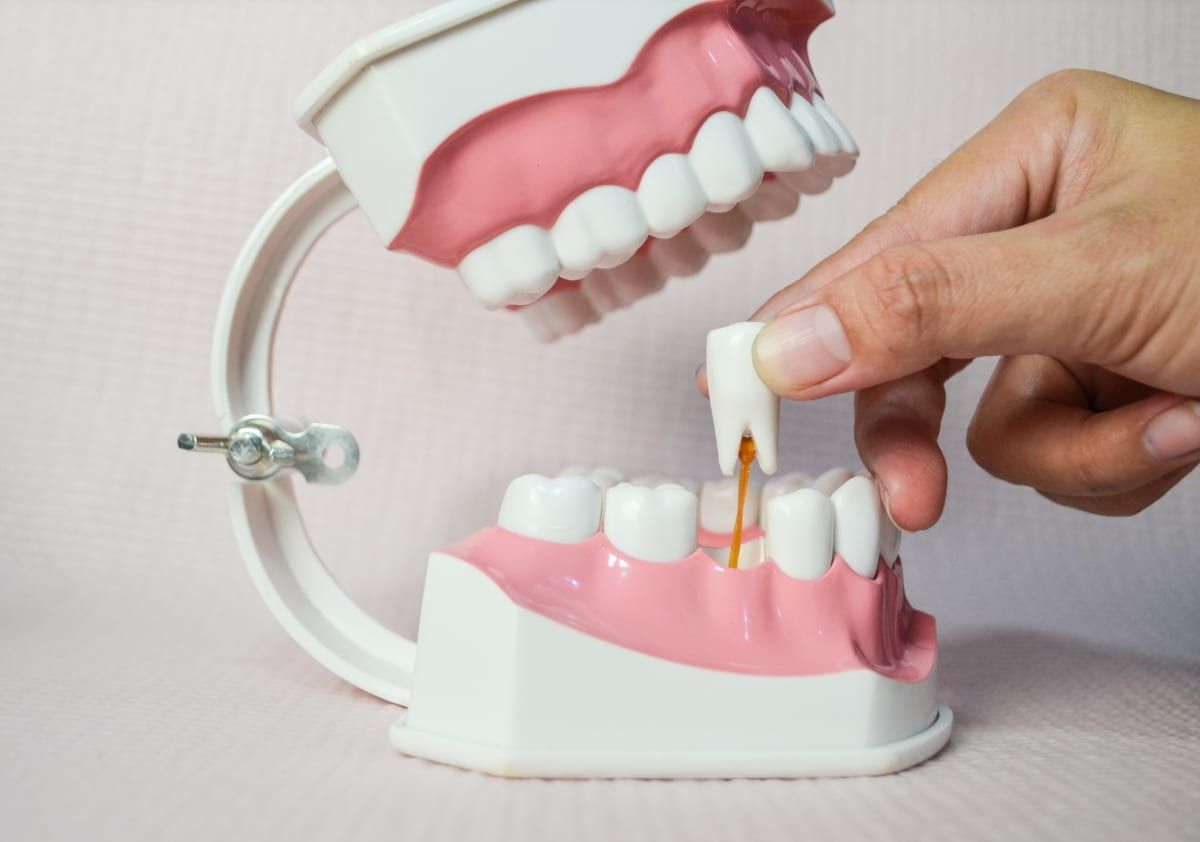 KFO Behandlung: Billiganbieter in Deutschland & Ausland ...